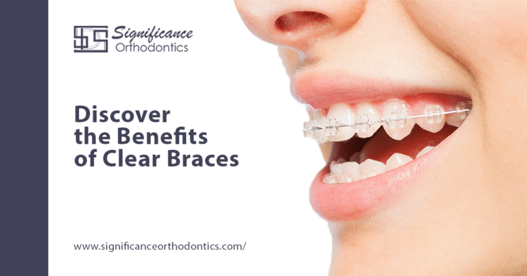 Discover the Benefits of Clear Braces